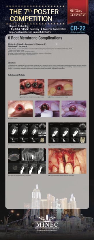 6 ROOT MEMBRANE COMPLICATIONS - MEGAGEN IMPLANT India