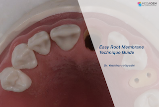 Easy Root Membrane Technique Guide - MegaGen Poland