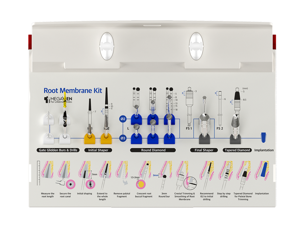 Root Membrane Kit - MEGAGEN IMPLANT