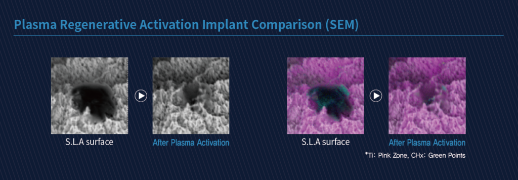 Plasma X Motion - MEGAGEN IMPLANT